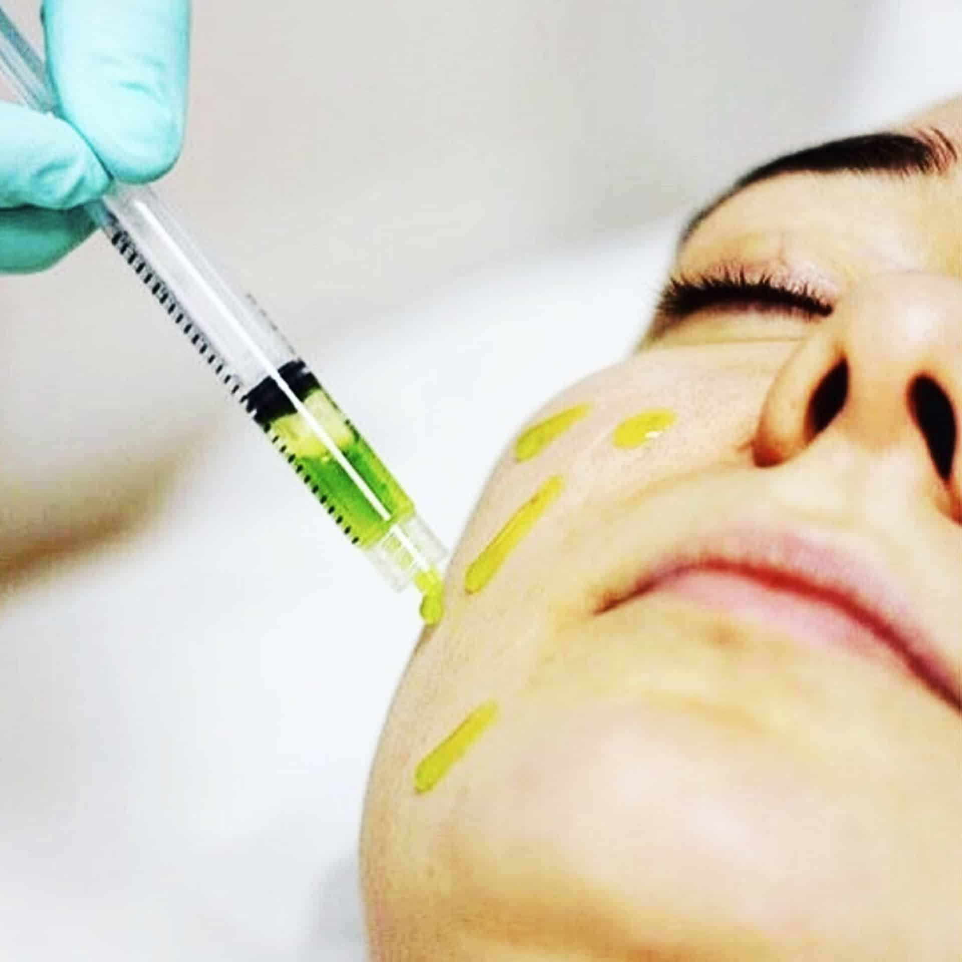 Chemical Peels in Royal Oak, Birmingham & Troy, MI